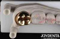 China Professional Grade Gold Crown For Dental Oral Clinical Application Yes Abrasive Resistance for sale