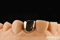 China Experience Oral Rehabilitation Like Never Before With Gold Crown Wax Casting for sale
