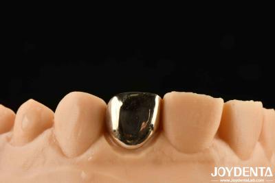 China Experience Oral Rehabilitation Like Never Before With Gold Crown Wax Casting for sale