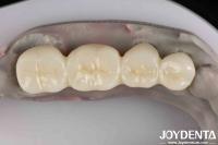 China Excellent White Product Full Zirconia With High Resistance To Corrosion Capability for sale