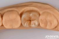 China High Precision Applications Full Zirconia With High Resistance To Thermal Shock for sale