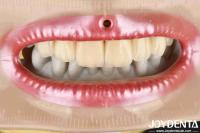 China Layered Zirconia High Aesthetics Excellent Biocompatibility Sintering Temperature 1350-1450°C For Advanced Materials for sale