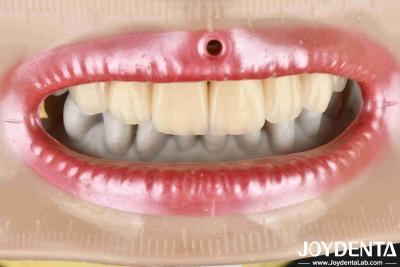 China Layered Zirconia High Aesthetics Excellent Biocompatibility Sintering Temperature 1350-1450°C For Advanced Materials for sale
