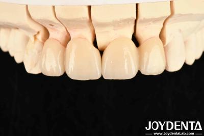 China High Translucency Layered Zirconia 3 W/mK Thermal Conductivity For Exceptional Performance for sale