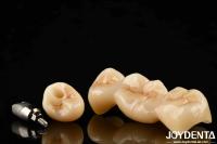 China Multilayer Full Zirconia High Resistance To Cracking And Durability For Long-Lasting Dental Restorations for sale