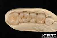 China Multilayer Full Zirconia White Style With Layers High Translucency High Resistance To Cracking for sale