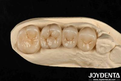 China Multilayer Full Zirconia White Style With Layers High Translucency High Resistance To Cracking for sale