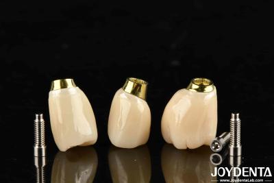 China High Durability White Finish Implant Crown And Bridge With Accurate Fit for sale