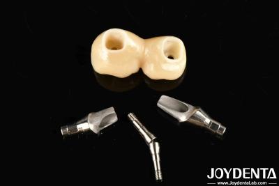 China Experience Aesthetically Pleasing Results With Customizable Implant Retained Crown And Bridge for sale