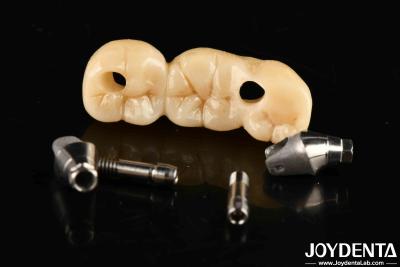 China Implant Crown And Bridge With Customizable Design High Durability Accurate Fit for sale