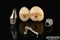 China Accurate Fit Implant-Supported Crown Bridge System With Resistance To Stains And Discoloration for sale