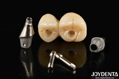 China Accurate Fit Implant-Supported Crown Bridge System With Resistance To Stains And Discoloration for sale
