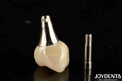 China Biocompatible Dental Implant Crown And Bridge Aesthetically Pleasing For Safe Oral for sale