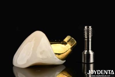 China Long-Lasting Implant Crown And Bridge For Restoring Missing Teeth Suitable For Dental Implants for sale