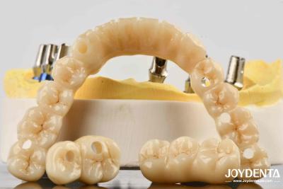 China Unmatched Accuracy Zirconia Implant Bridge Commitment To Comfort for sale