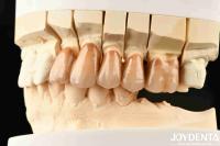 China Bionic Teeth Layered Zirconia with Bionic Leaf Micro-Engraving and Multi-color Biomimetic Lamination for Advanced Light Simulation for sale