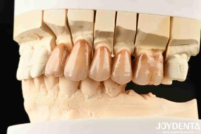 China Bionic Teeth Layered Zirconia with Bionic Leaf Micro-Engraving and Multi-color Biomimetic Lamination for Advanced Light Simulation for sale