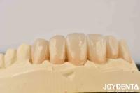 China Let The Light Dance In Zirconia Building The Transparency Of Enamel And The Warmth Of Dentin for sale