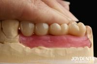 China Ultra-precision processing Zirconia Implants with AI-assisted Design and Bionic Gingival Piercing for All-Zirconium Integrated Crown for sale