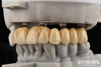 China Close Friends Of Bones Foundation Of Beauty Zirconia Implants Aesthetically Supreme Choice With No Risk Of Metal Allergy for sale