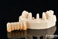 China Unveil True Biomimicry: Introducing Our Multi-Layered Zirconia Aesthetic Bridge for sale