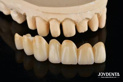 China Unveil True Biomimicry: Introducing Our Multi-Layered Zirconia Aesthetic Bridge for sale