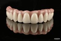 China Natural Look Dental Laboratory Acrylic Teeth Finish For High Wear Resistance for sale