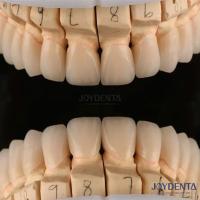 China Polished Layered Dental Zirconia 0.3-0.5mm Thickness With CAD CAM Technology for sale