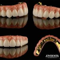 China Ti Bar Zirconia Hybrid Implant Bridges High Translucency For Dental Prosthesis for sale