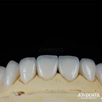 China Glossy Surface Texture Feldspathic Veneer Natural Looking Porcelain Veneer for sale