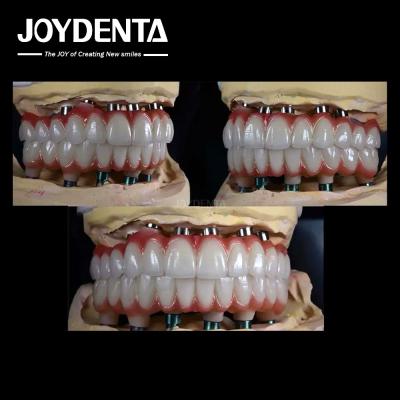 China 10mm Titanium Multiple Teeth Implant Rough Surface For Dental Restoration for sale
