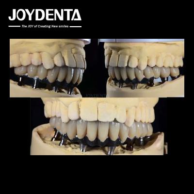 China Titanium Multiple Teeth Dental Implant Prosthetic Surgery External Hexagon Connection for sale