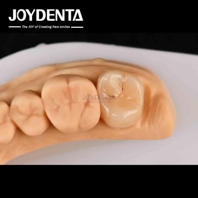 China High Strength Emax Inlay Onlay A2 Color Long Lasting For Damaged Teeth Restoration for sale