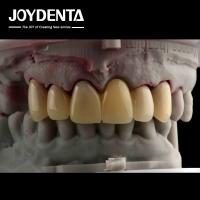 China CAD CAM Processing Dental PMMA Material Multilayer Design For Natural Shade Transitions for sale