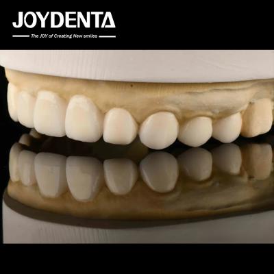 China Dental Biomimetic Aesthetic Diagnostic  Wax-Up Of Veneers for sale