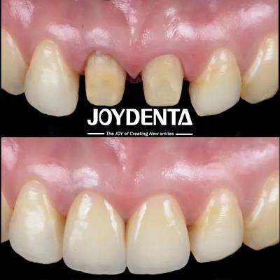 China High Fracture Resistance Dental Zirconia And Multilayered Gradient Technology for sale