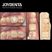 China Biocompatibility And High Compatibility With Natural Teeth Restoration for sale