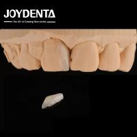 China Thin Shell Micro Veneer Cosmetic Dental Treatment Micro Thin Teeth Veneers for sale