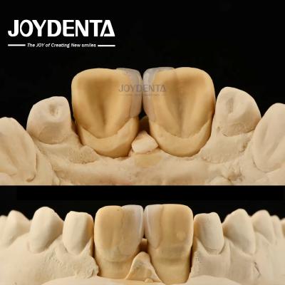 China 0.2mm Thickness Microthin Veneers Glass Ceramic Dental Veneers For Front Teeth for sale