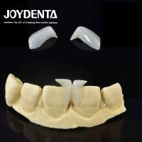 China Customizable Smooth Micro Thin Veneers Long Lasting Natural Looking Veneers for sale