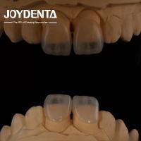 China Eco Friendly Micro Dental Teeth Veneer 0.2mm Thickness Smooth Texture for sale
