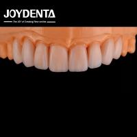 China Customizable Glass Ceramic Veneer Natural Looking High Chemical Resistance for sale