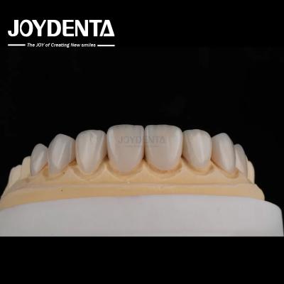 China Real Looking Glass Ceramic Teeth Veneers With Glossy Or Matte Surface Finish for sale