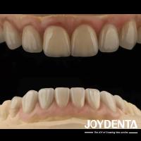 China High Translucency Emax Cosmetic Dentistry Veneers High Aesthetics Ultra Thin for sale