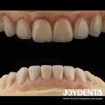 China High Translucency Emax Cosmetic Dentistry Veneers High Aesthetics Ultra Thin for sale
