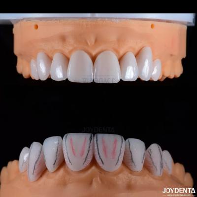 China Custom Made Dental Emax Ceramic Veneers With Stain Resistance High Gloss for sale