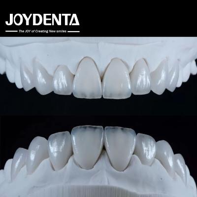 China Natural Looking Emax Porcelain Veneer Comfortable Fit Ultra Thin Emax Veneers for sale