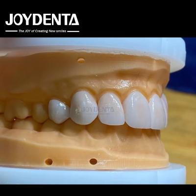 China High Permeability Natural Looking Veneers Porcelain Veneers Emax Customized for sale