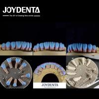 China High Biocompatibility Feldspathic Ceramic Veneer Glossy For Dental Restorations for sale