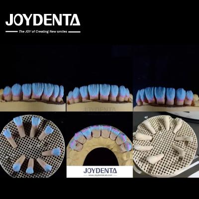China High Biocompatibility Feldspathic Ceramic Veneer Glossy For Dental Restorations for sale